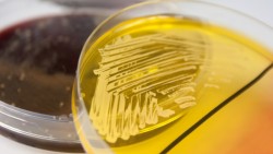 Cum îţi dai seama că ai fost infectată cu stafilococ auriu | avantaje.ro