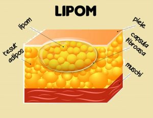 Ce să faci dacă ai umflături sub piele | avantaje.ro