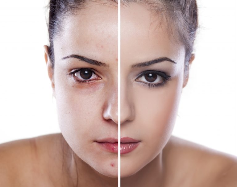 Masca revoluționară pentru riduri, rozacee, acnee şi cearcăne, care te ...