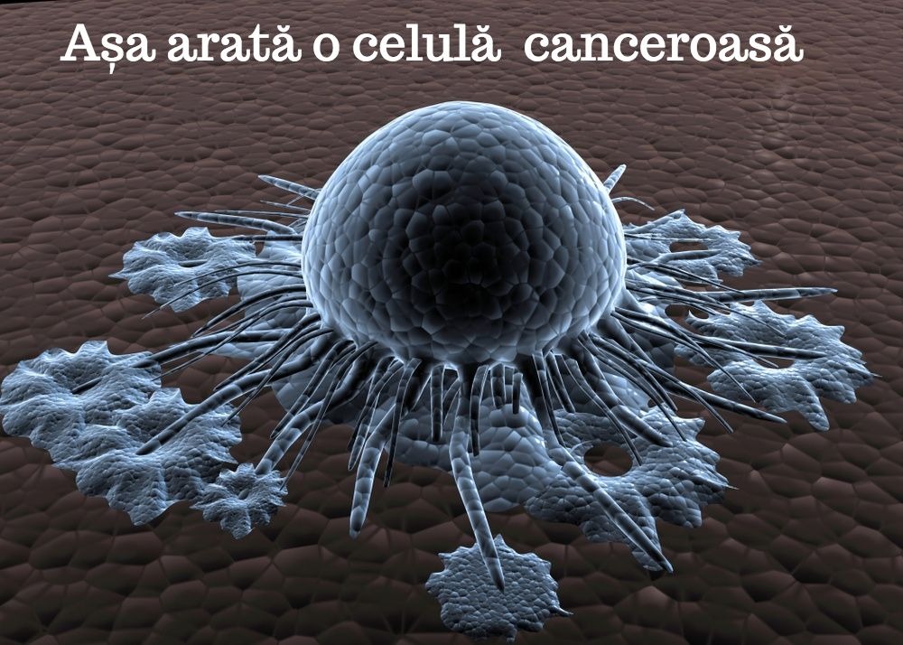 Ce Este Cancerul Tot Ce Trebuie Sa Stii Cancer | My XXX Hot Girl