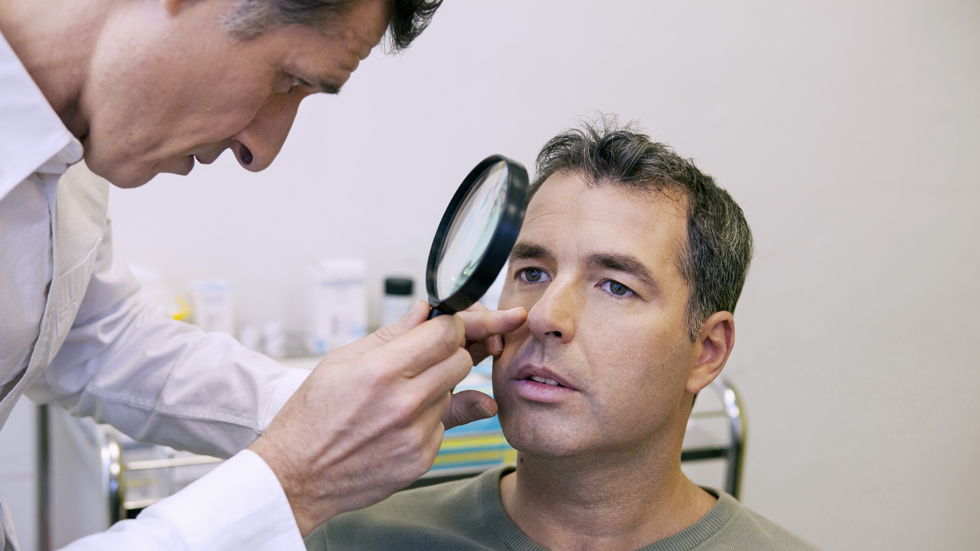 Cancerul de piele. Simptomul observat când dai cu aspiratorul