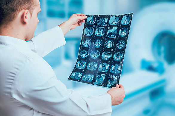 Tot ce trebuie să știi despre screening. Tipuri de cancer pentru care ...