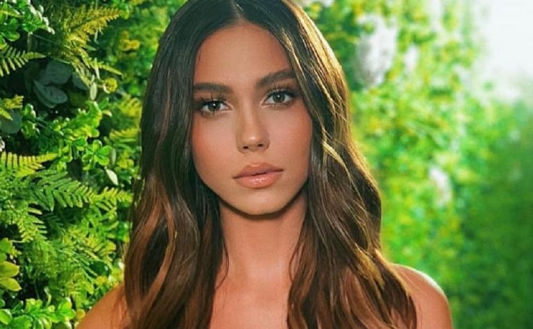 Mira a descoperit că are mai 5 cioburi în faţă dupa accident