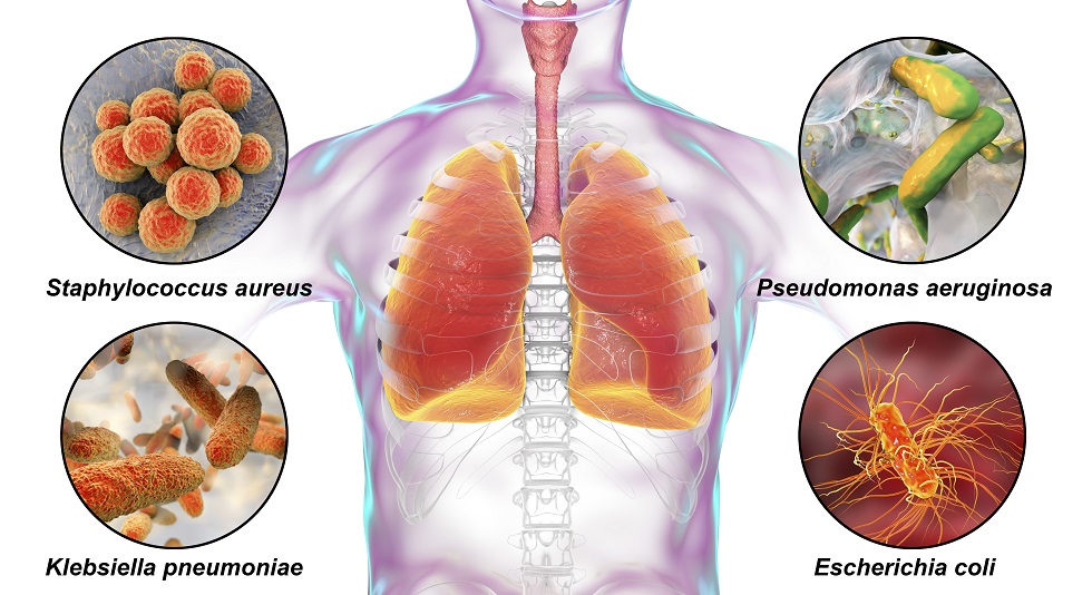Ce sunt infecțiile nosocomiale și care sunt cele mai des întâlnite ...