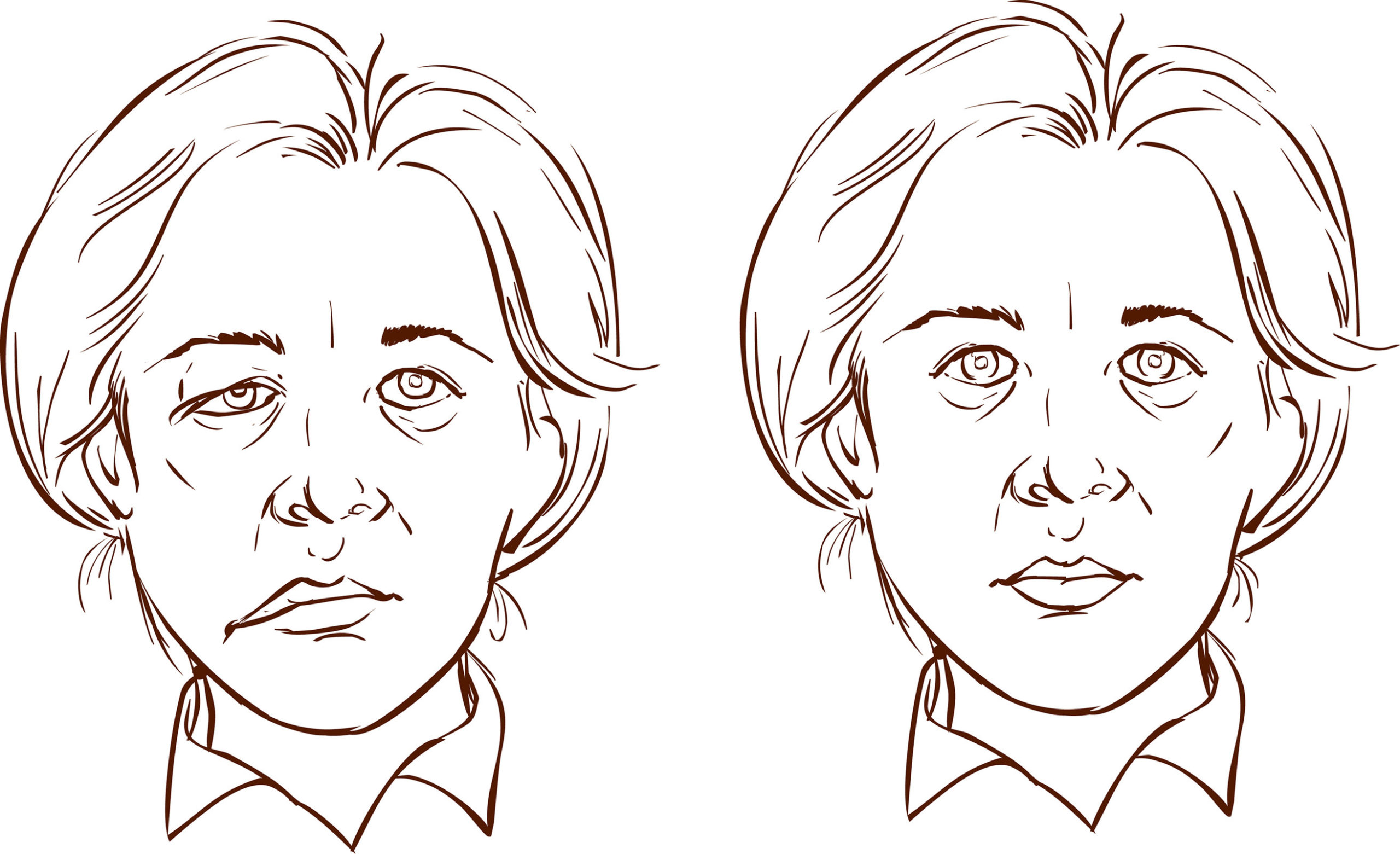 Asimetrie facială. Ce este și când ar trebui să fii îngrijorat?