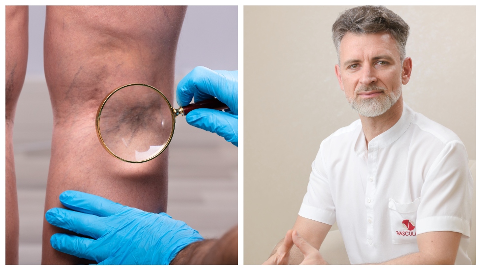 Dr. Toni Feodor: "Compresia reprezintă una dintre metodele eficiente de ...