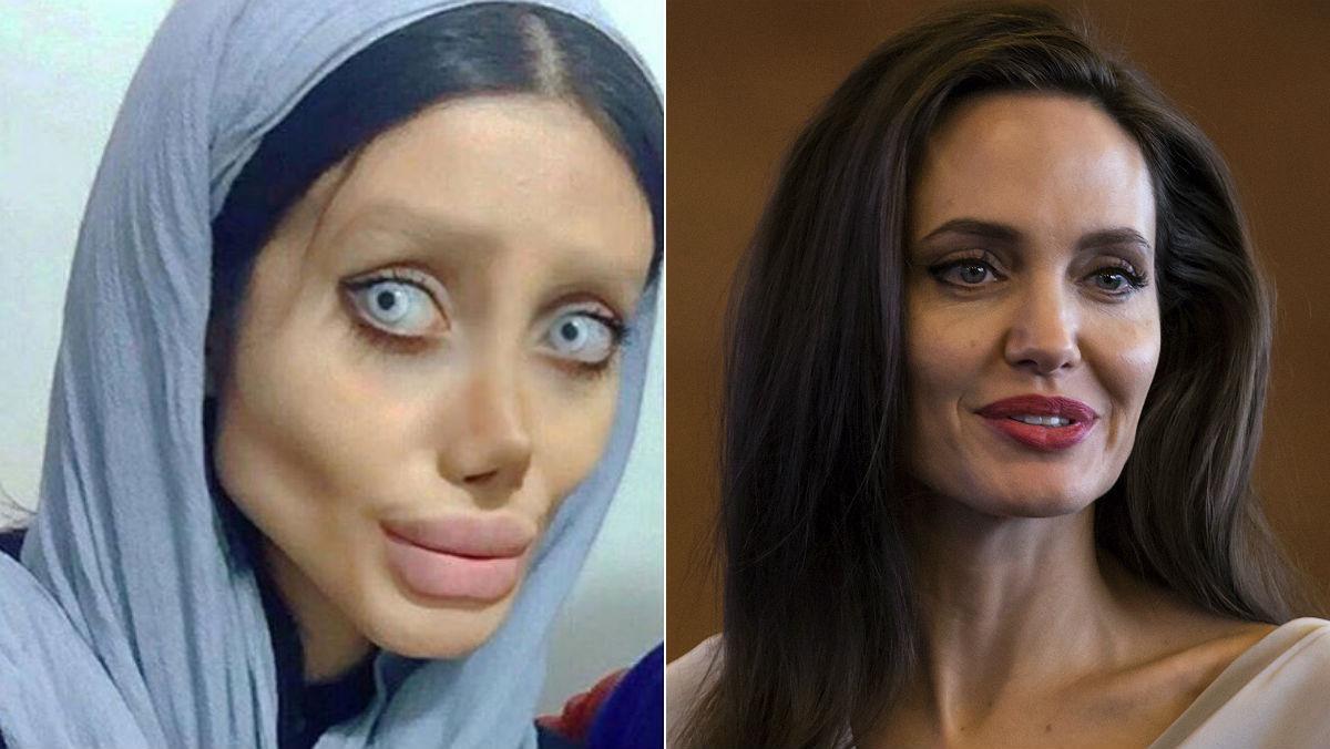 Sahar Tabar, femeia care s-a operat să arate precum Angelina Jolie, și ...