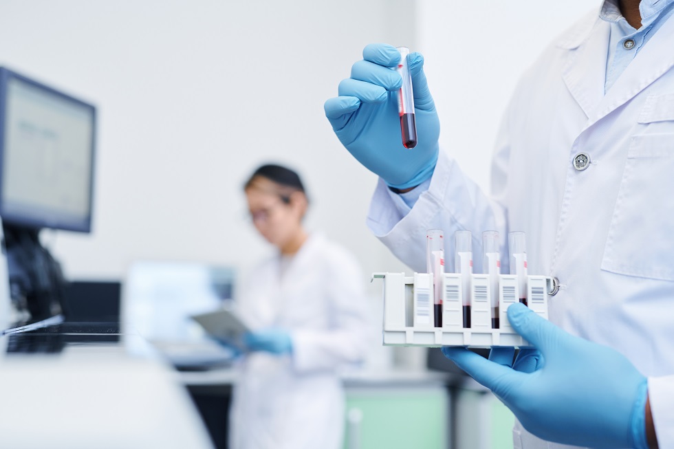 În sfârșit!!! Testul de sânge care poate detecta 50 de tipuri de cancer